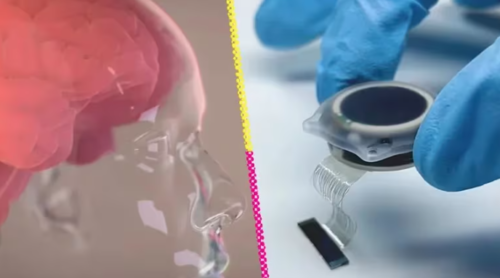 Así funciona el primer chip cerebral de la empresa de Elon Musk Así funciona el primer chip cerebral de la empresa de Elon Musk