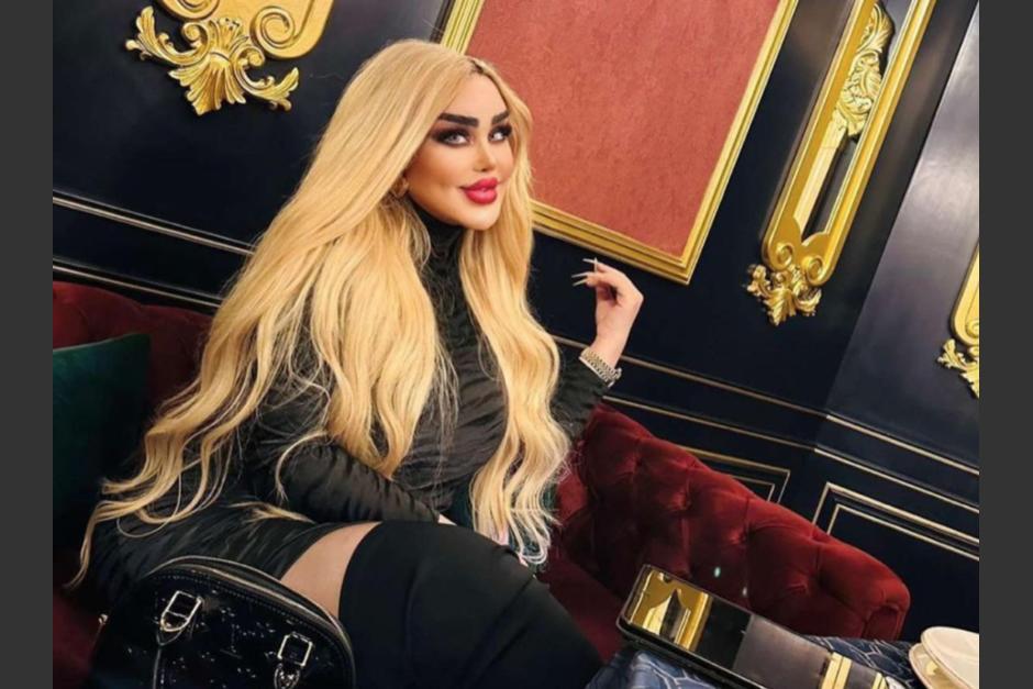 Conductora quería parecerse a Barbie y ahora luce irreconocible