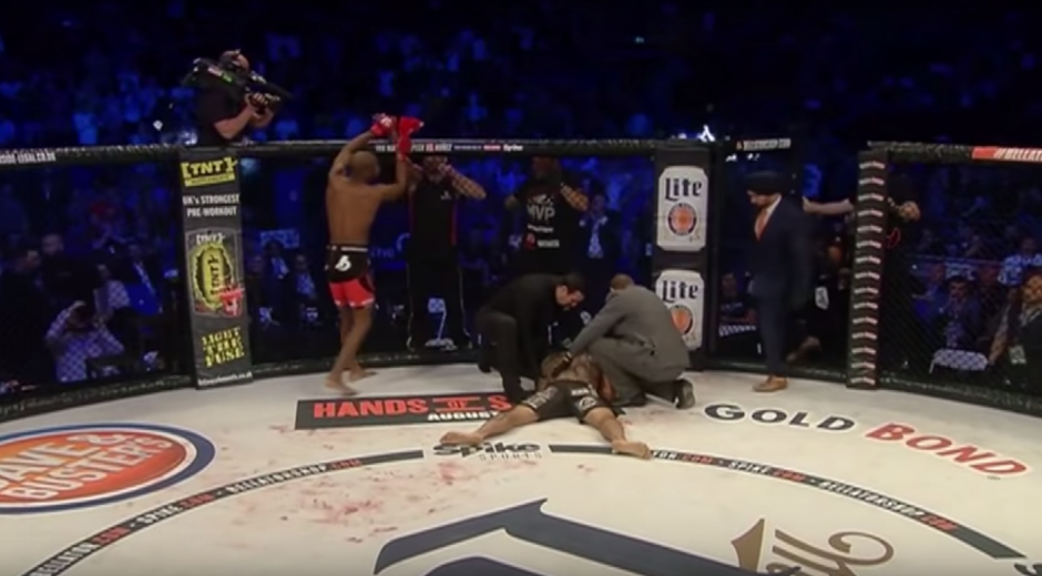 Peleador MMA sufre hundimiento del cráneo tras rodillazo | Soy502